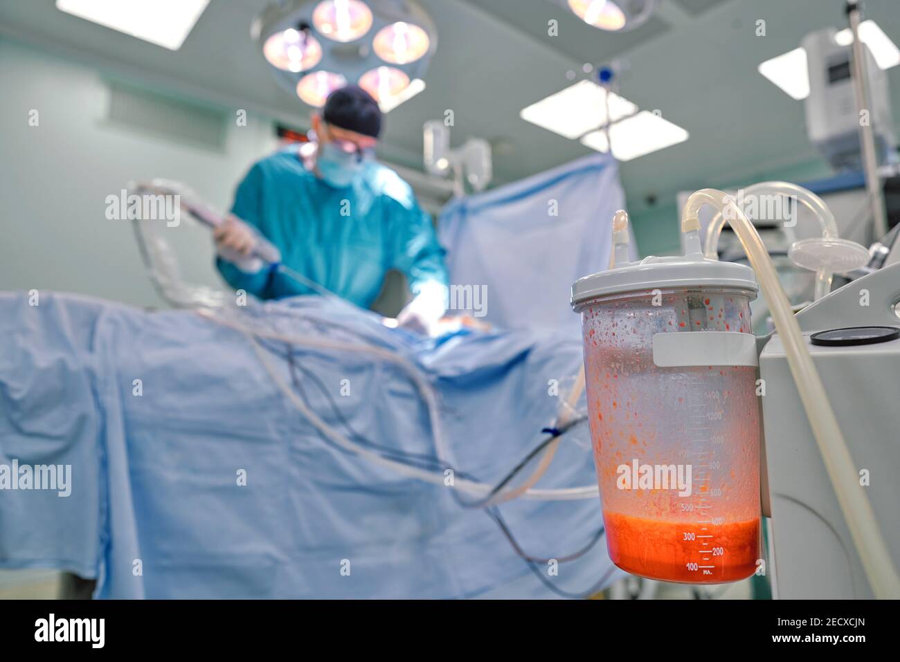 surgeon during liposuction in the operating room Stock Photo - Alamy