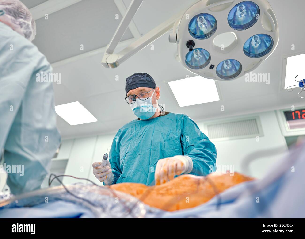 surgeon during liposuction in the operating room Stock Photo - Alamy