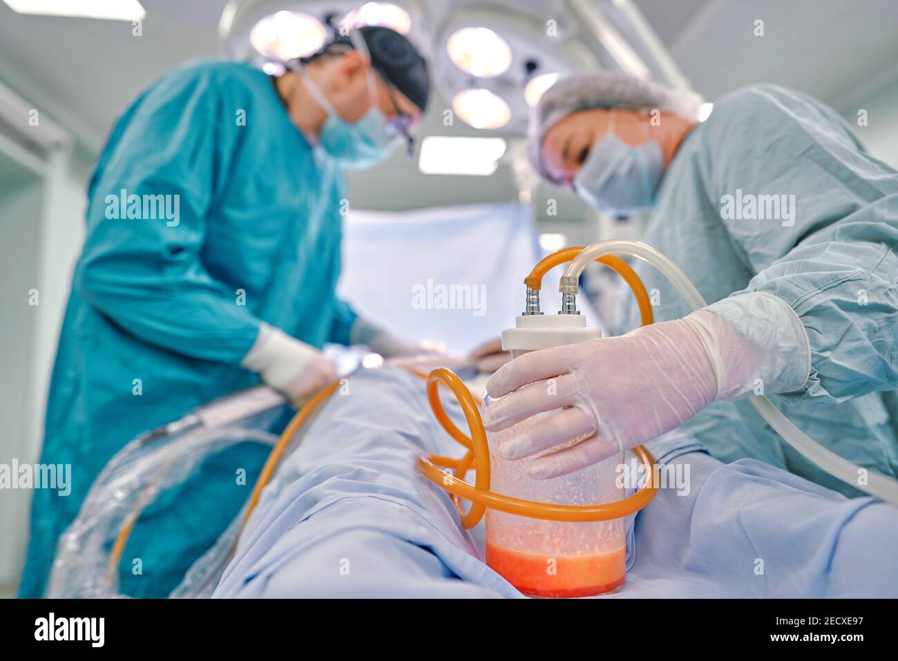 surgeon during liposuction in the operating room Stock Photo - Alamy