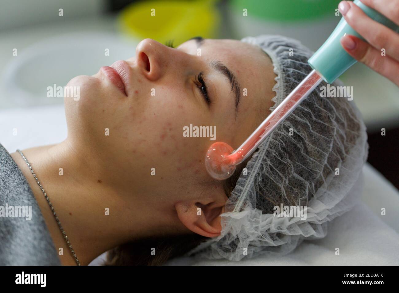 Violet ray treatment on face at the beautician. A violet ray is an ...