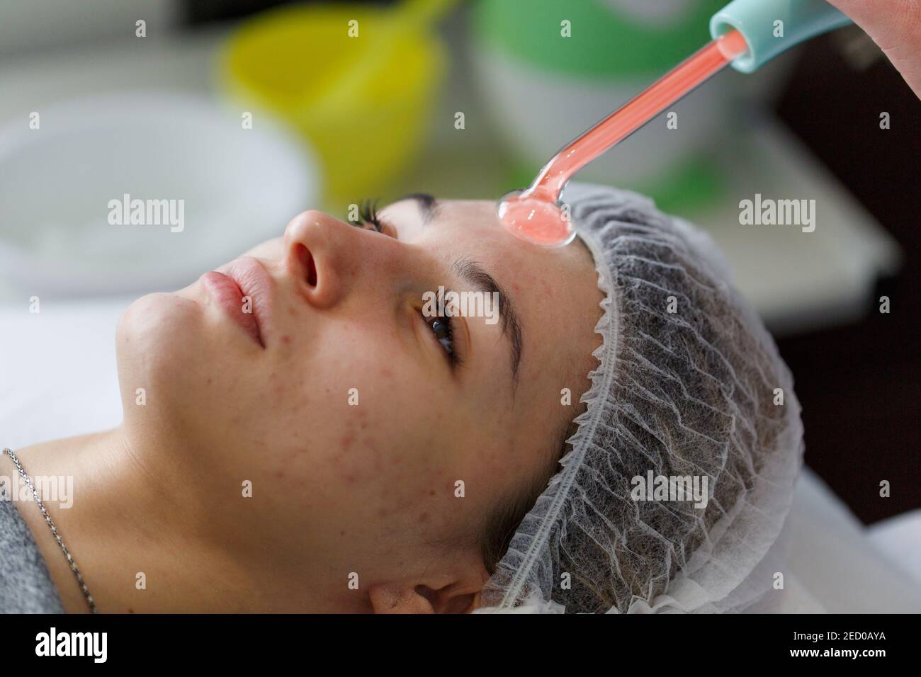 Violet ray treatment on face at the beautician. A violet ray is an ...