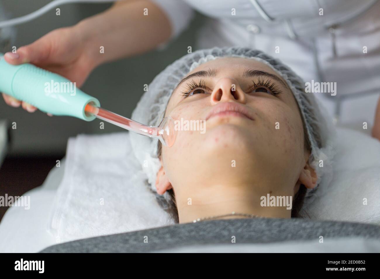 Violet ray treatment on face at the beautician. A violet ray is an ...