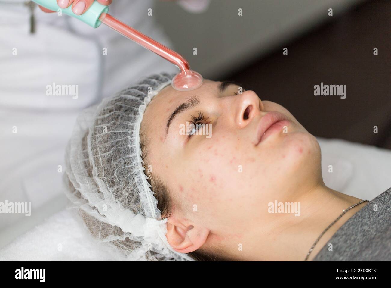 Violet ray treatment on face at the beautician. A violet ray is an ...