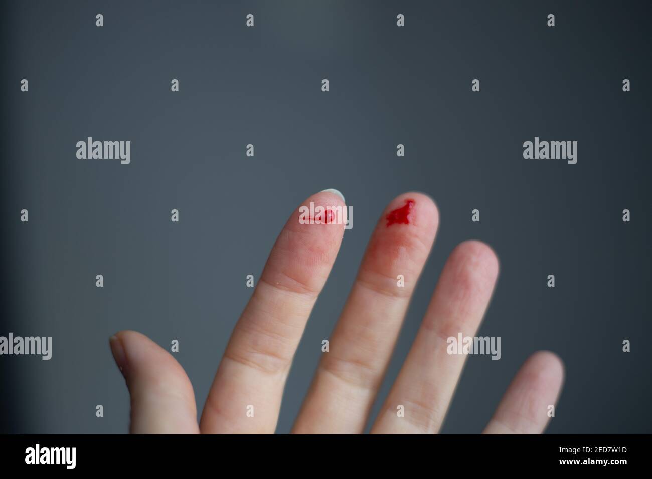 Wounds of experience hi-res stock photography and images - Alamy
