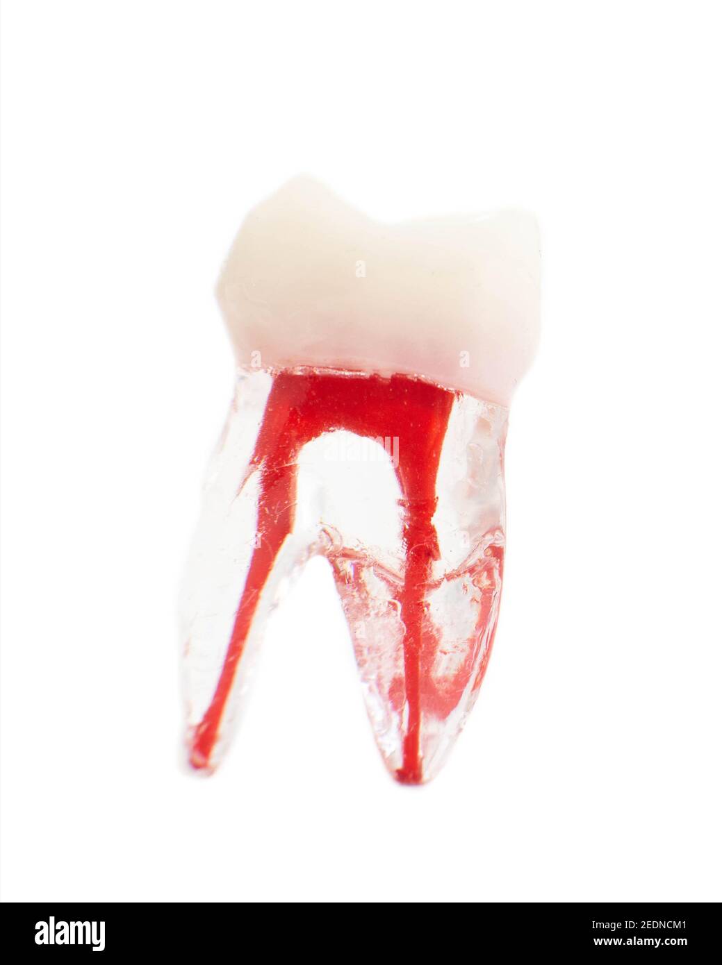 Tooth mockup on white background, isolate. Tooth root, dentistry ...