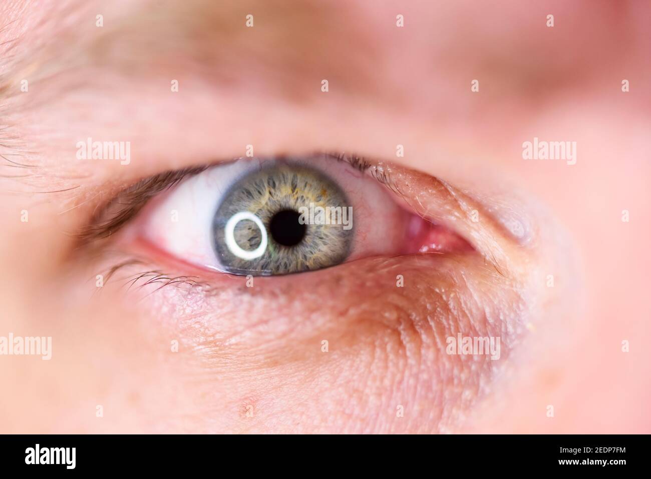 Human eye view hi-res stock photography and images - Alamy