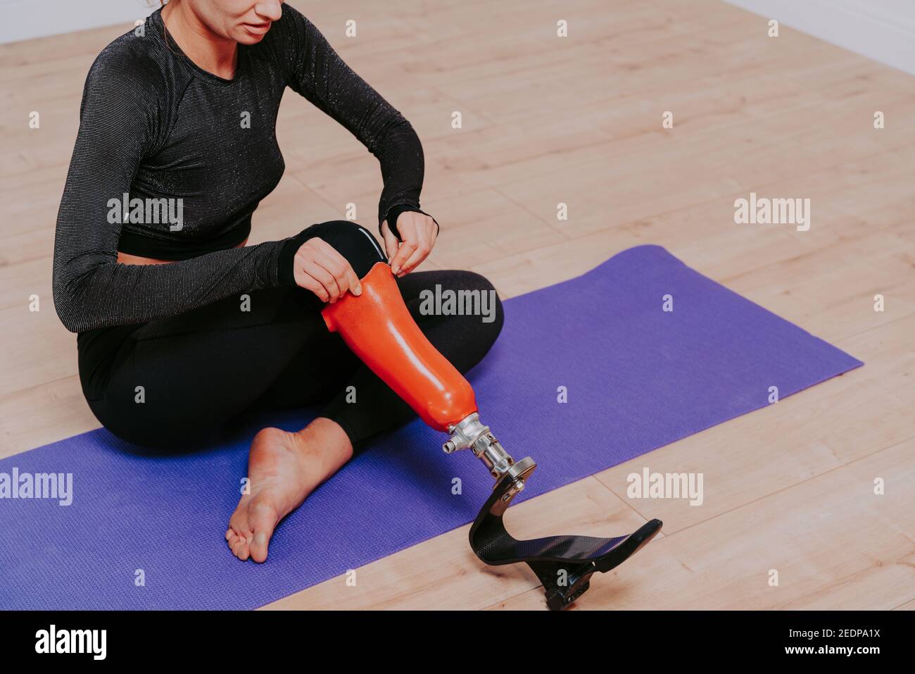 Beautiful young woman with amputation - Pretty and confident woman with ...