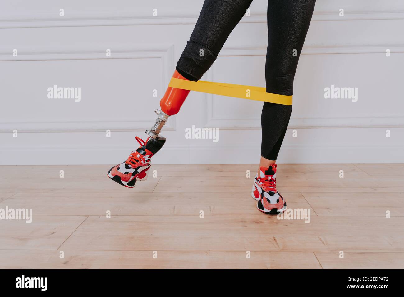 Beautiful young woman with amputation - Pretty and confident woman with ...