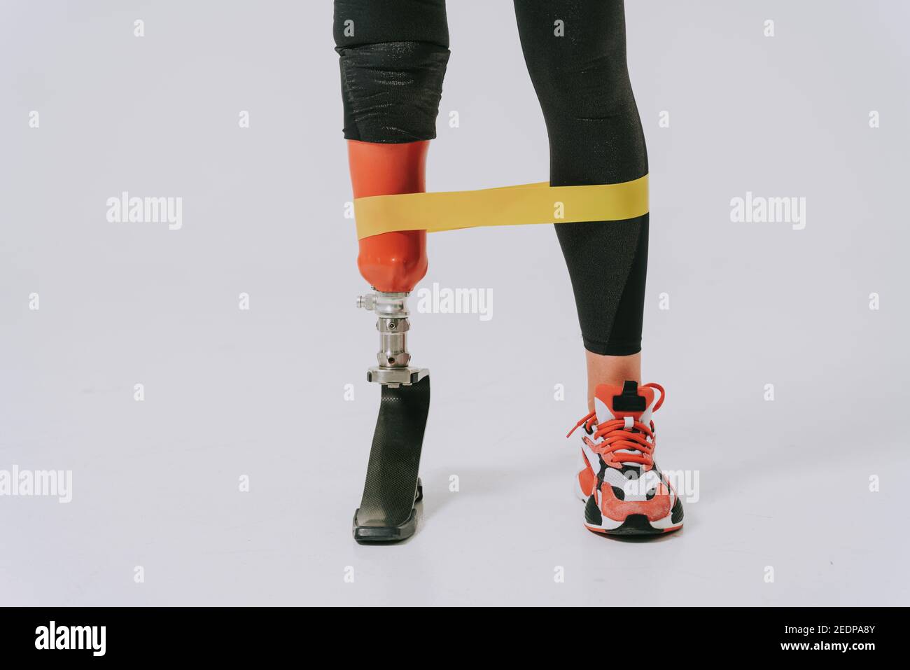 Beautiful young woman with amputation - Pretty and confident woman with ...