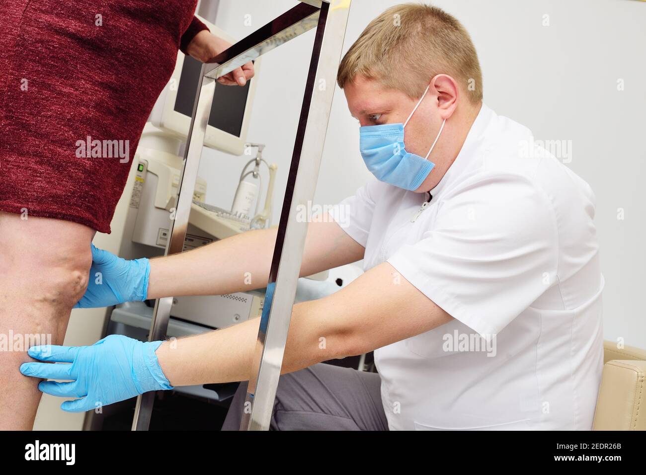 a phlebologist or vascular surgeon examines the varicose veins of the ...