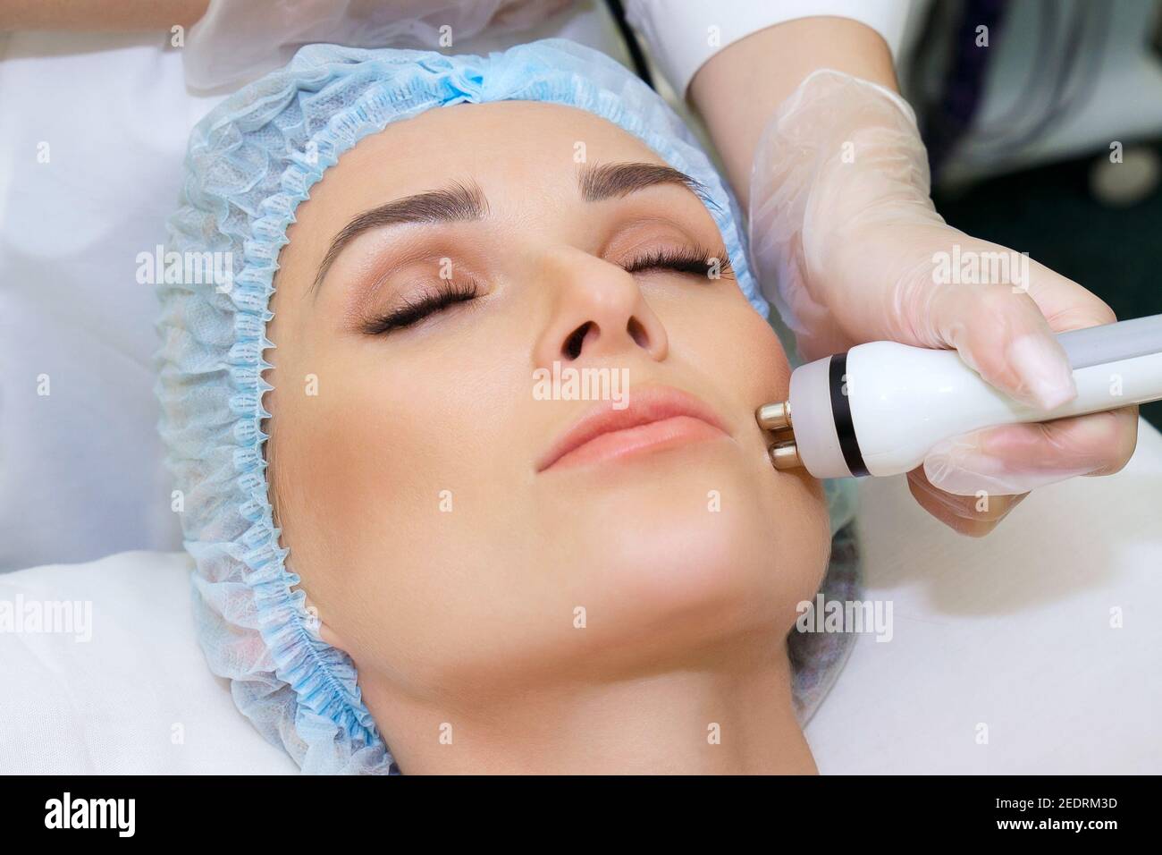 RF lifting procedure on the face of a young woman in a spa salon ...