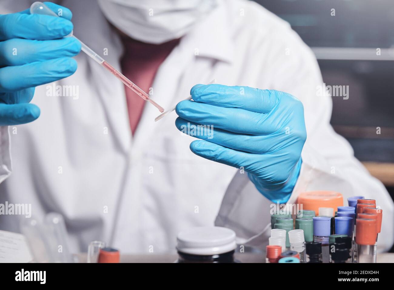 Microscope sample hi-res stock photography and images - Alamy