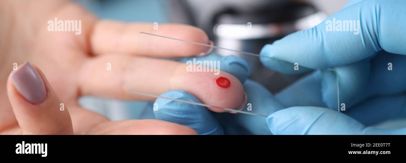 Doctor in protective gloves touching drop of blood on patients hand ...