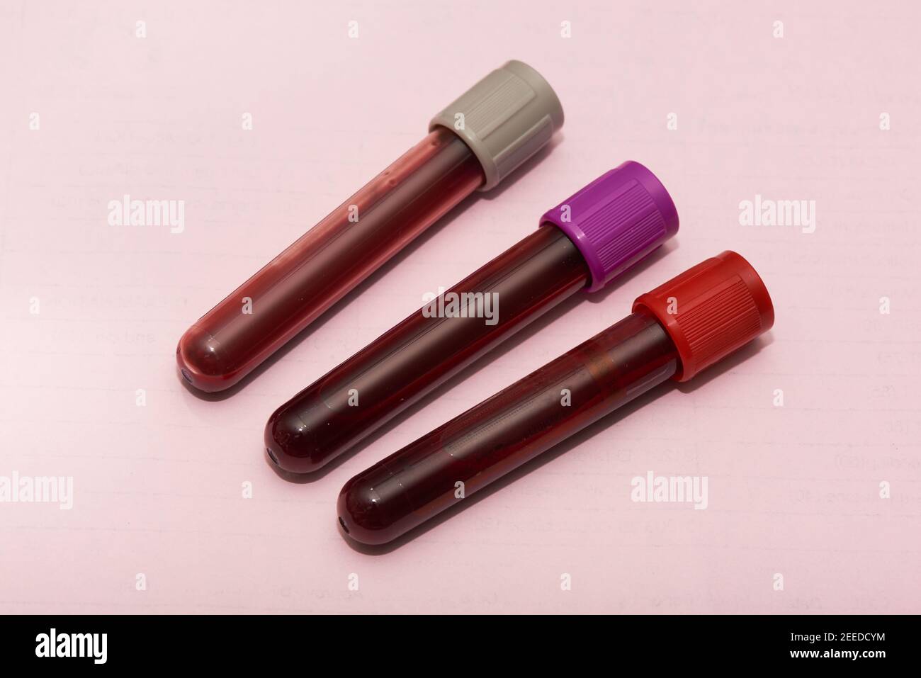 Three blood samples in test tubes for laboratory examination Stock ...