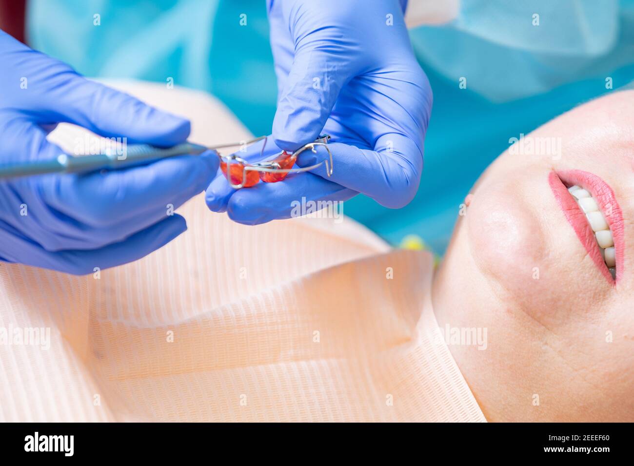Making cast of the upper row of teeth using a special plate and soft ...