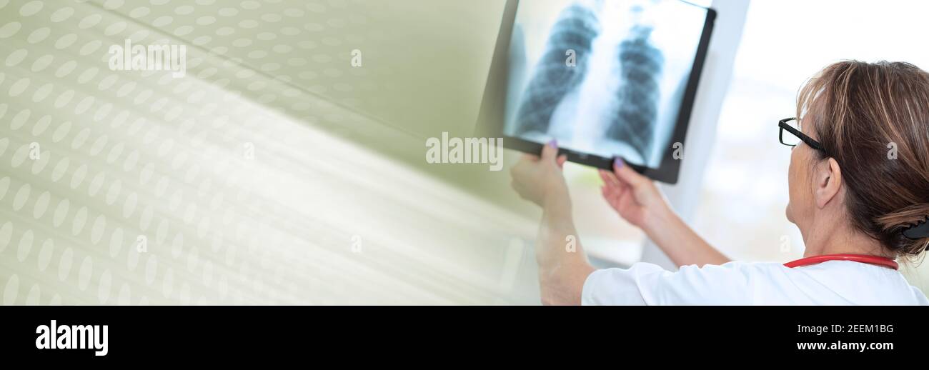 Female doctor looking at x-ray in clinic; panoramic banner Stock Photo ...