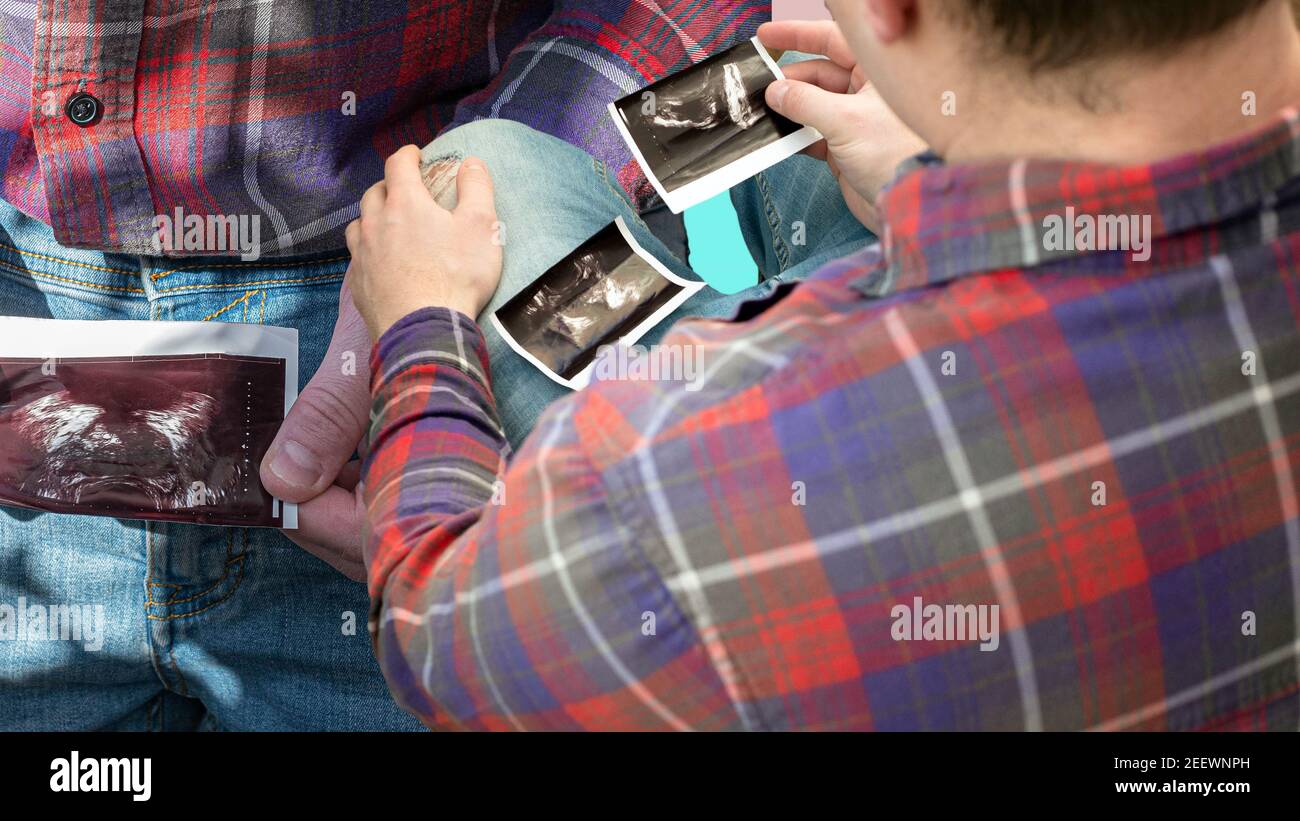 A man in the clinic in the ultrasound of the prostate in his hands, a ...