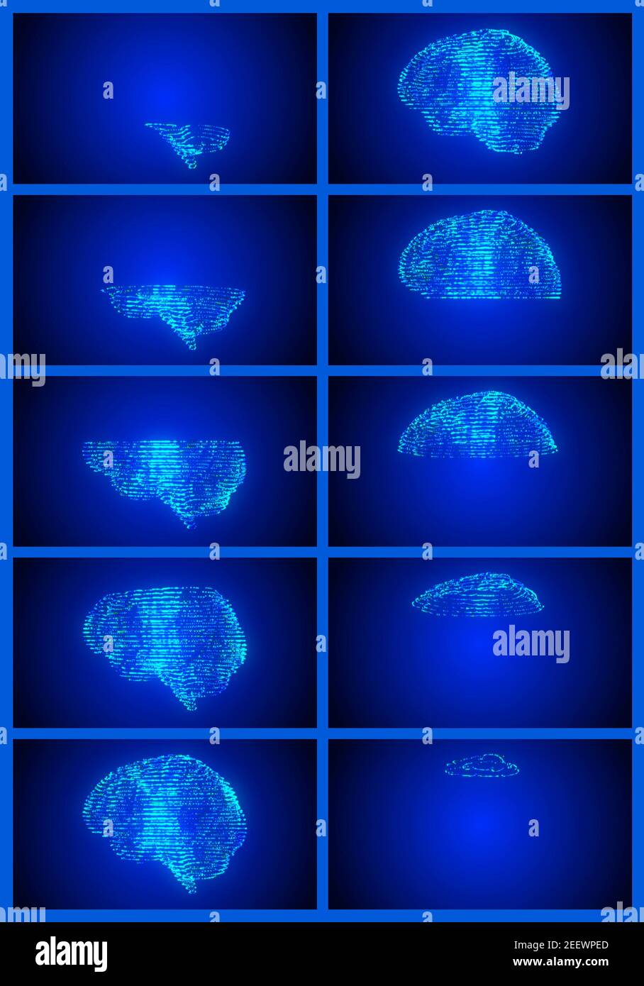 Brain study, MRI, brain section analysis. Technologies and medicine ...