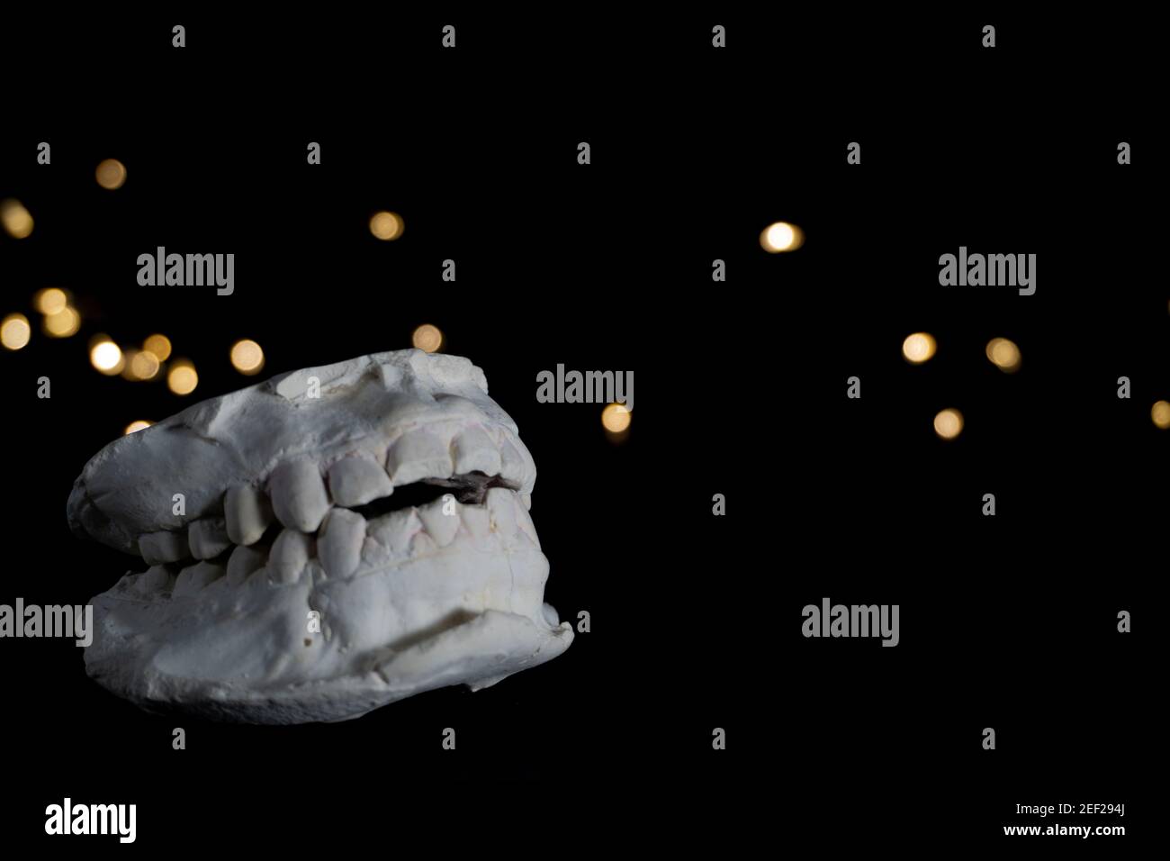 gypsum model of a human teeth on black background. Orthodontic cast of ...