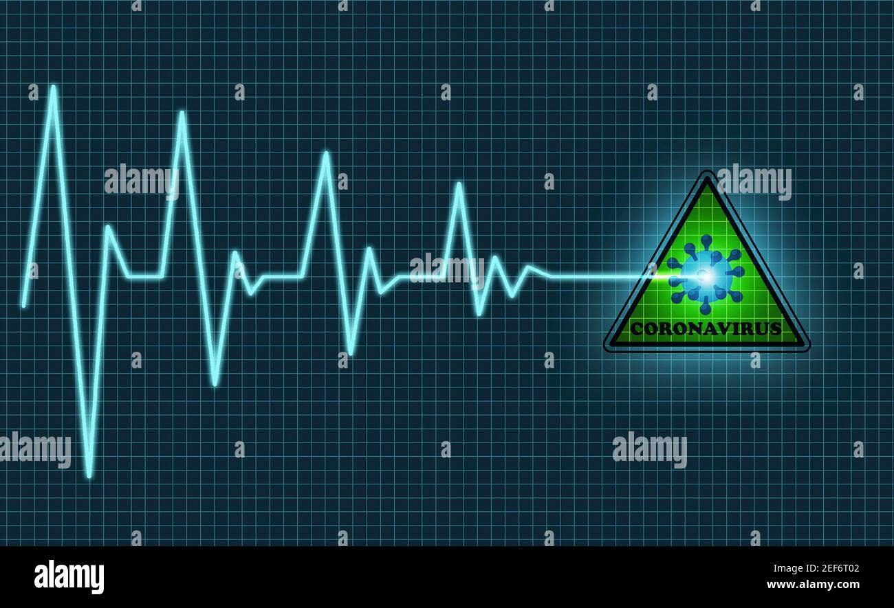 Cardiogram chart shows coronavirus death Stock Photo - Alamy