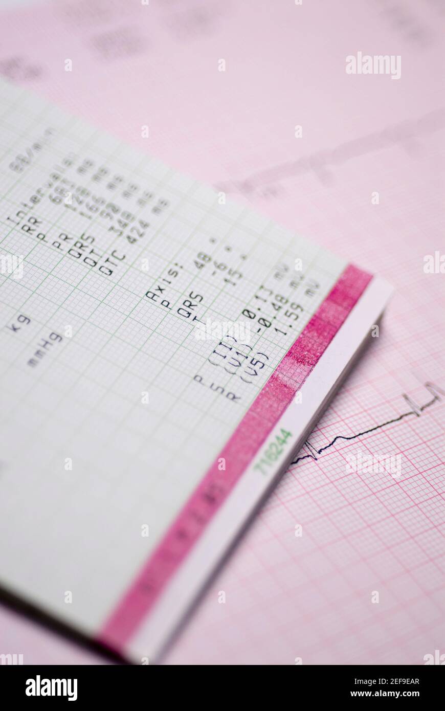 Close up electrocardiogram hi-res stock photography and images - Alamy