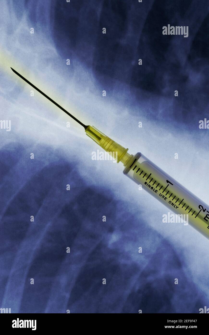 X ray test objects hi-res stock photography and images - Alamy