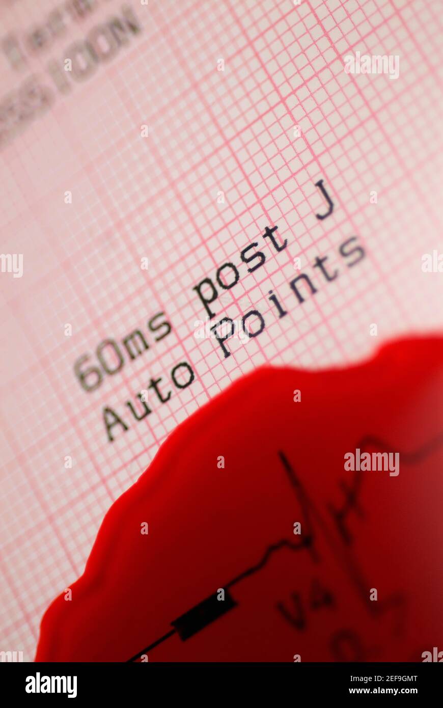 Close up of blood split on an electrocardiogram report Stock Photo - Alamy