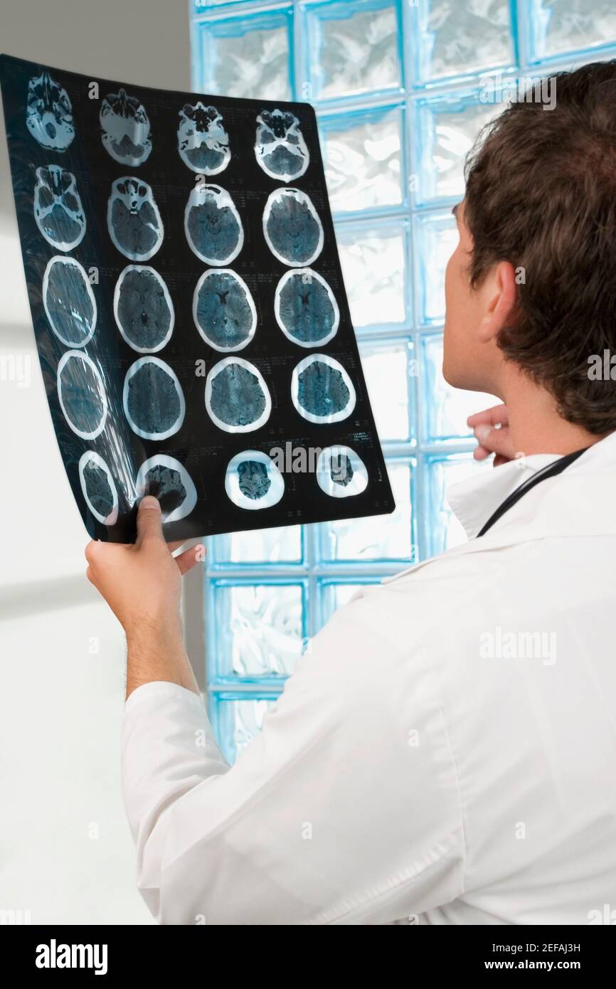 Male doctor examining an X Ray report Stock Photo - Alamy