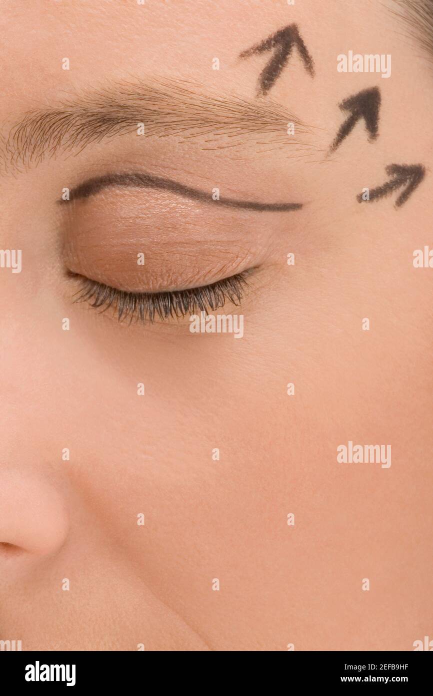 Close up of a young woman with pre surgical markings on her face Stock ...