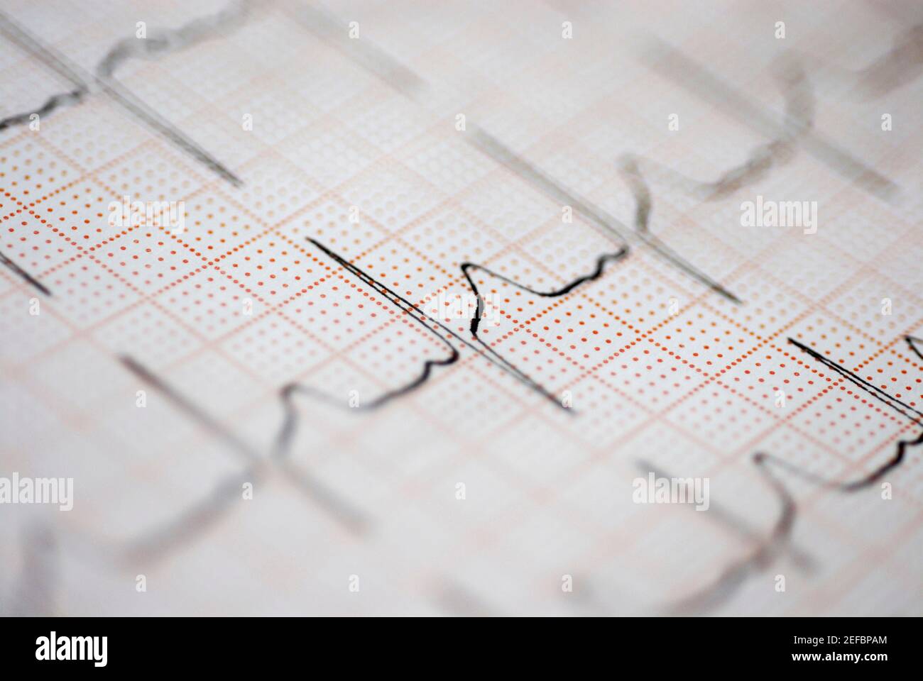 Ecg analysis hi-res stock photography and images - Alamy