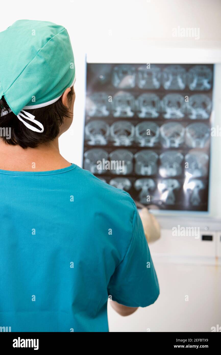 Doctor checking on ray hi-res stock photography and images - Alamy