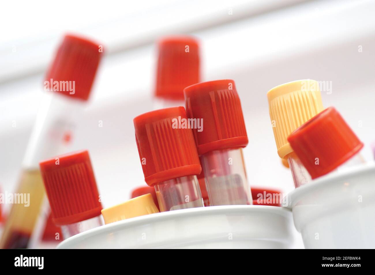 Close-up of vials in containers Stock Photo - Alamy
