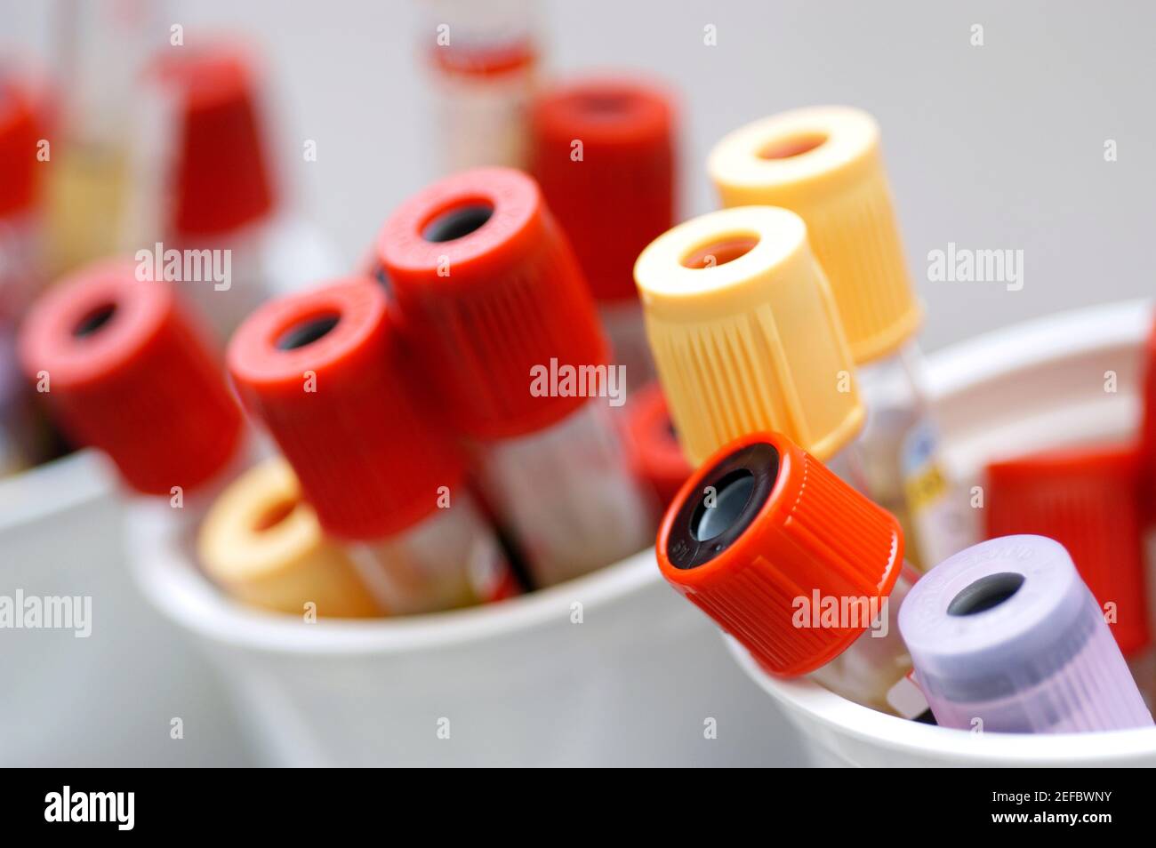 Large test tubes hi-res stock photography and images - Alamy