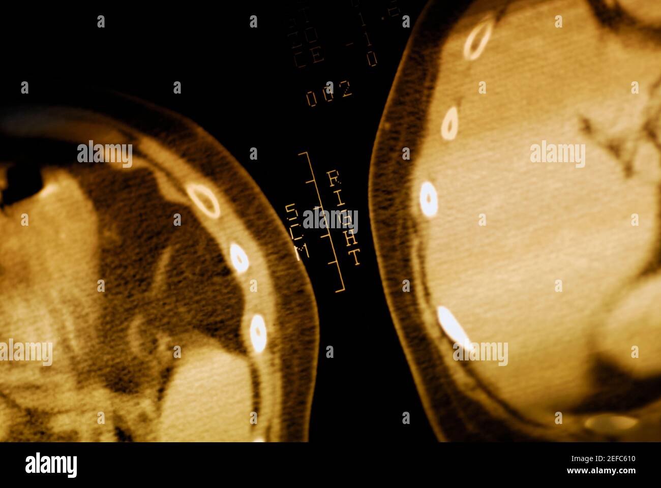 Mri alphabet hi-res stock photography and images - Alamy