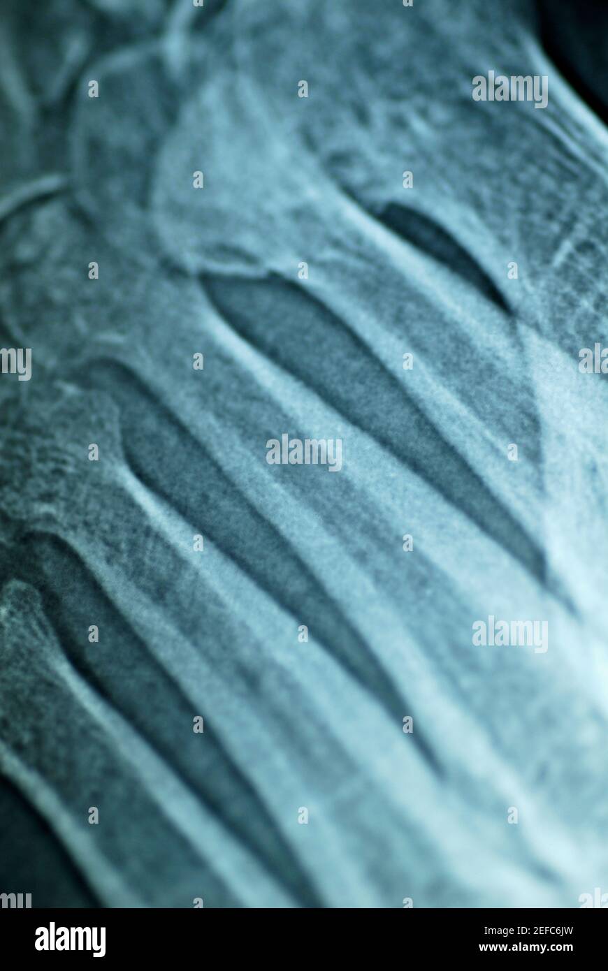 X-Ray image of human bones Stock Photo - Alamy