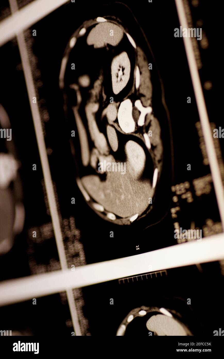 Mri scan brain color hi-res stock photography and images - Alamy