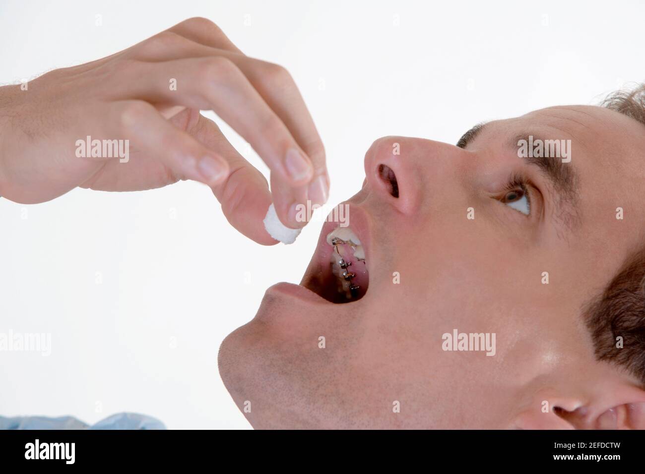 Adult braces open mouth hi-res stock photography and images - Alamy