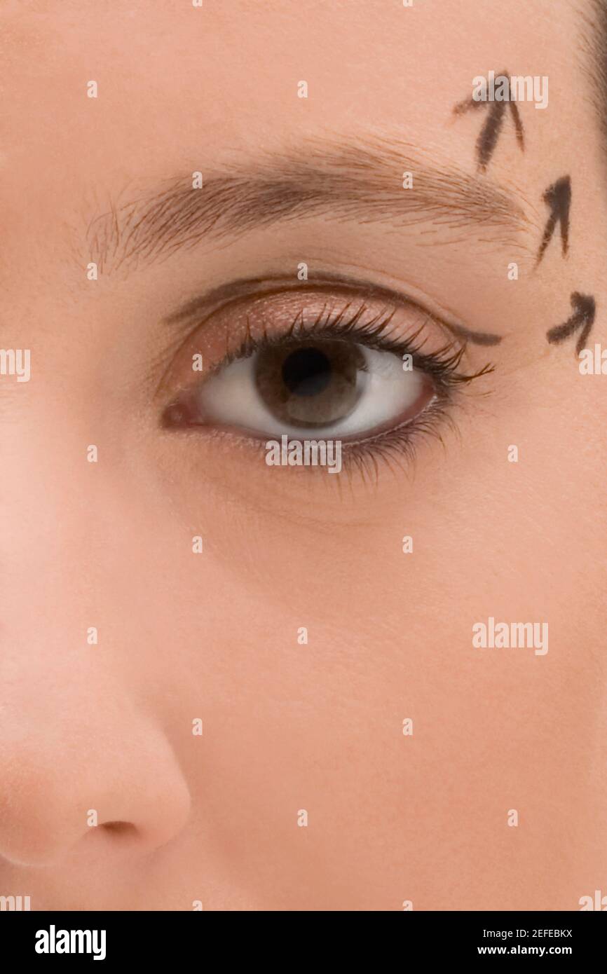 Woman plastic surgery markings on hi-res stock photography and images ...