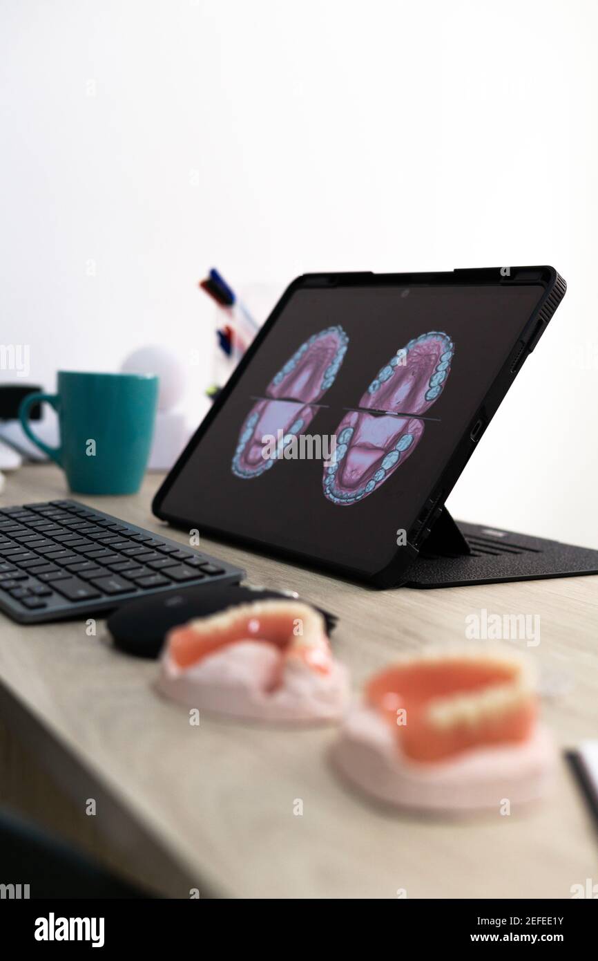 Complete denture hi-res stock photography and images - Alamy