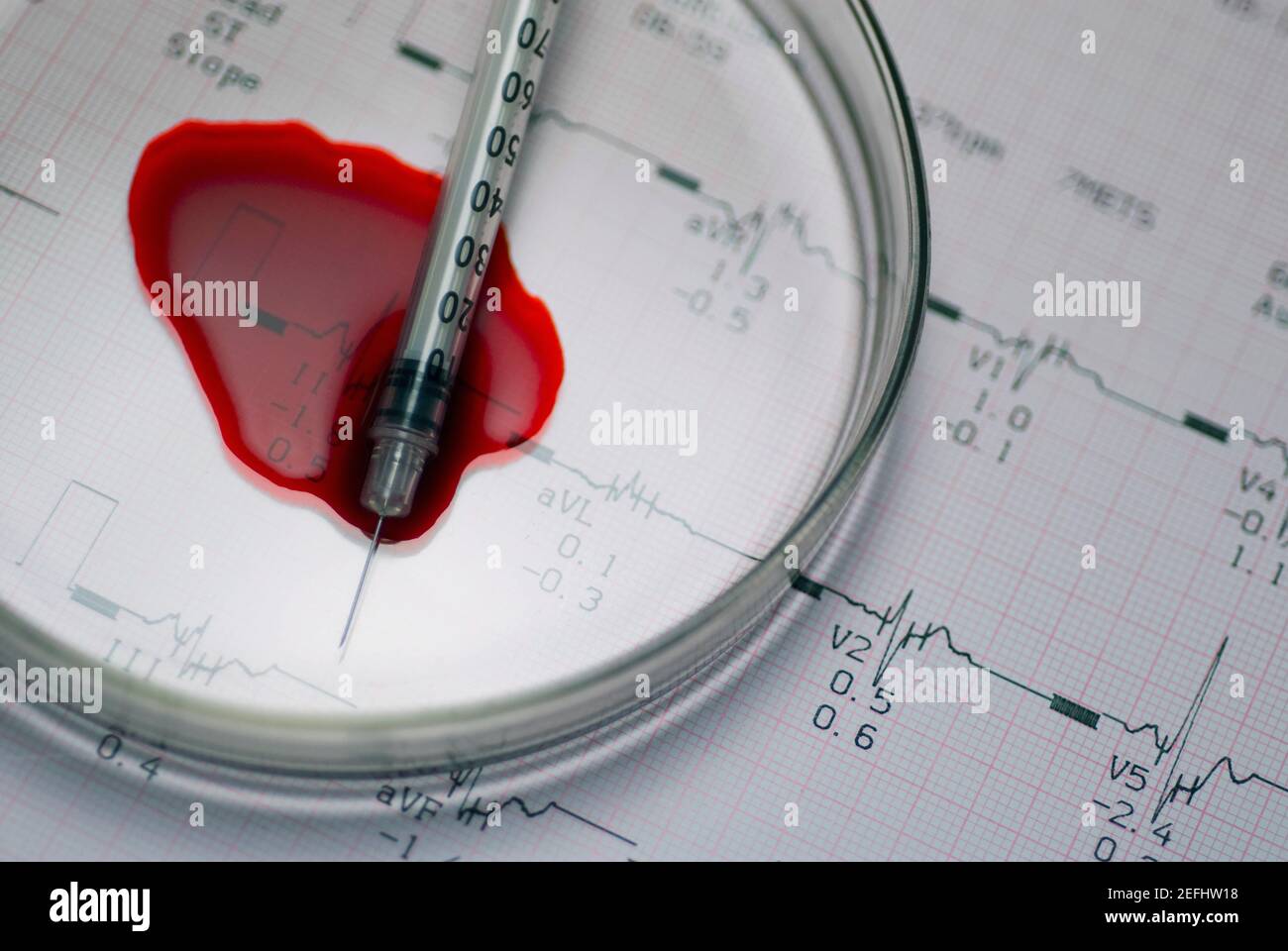 Magnify glass photography hi-res stock photography and images - Alamy