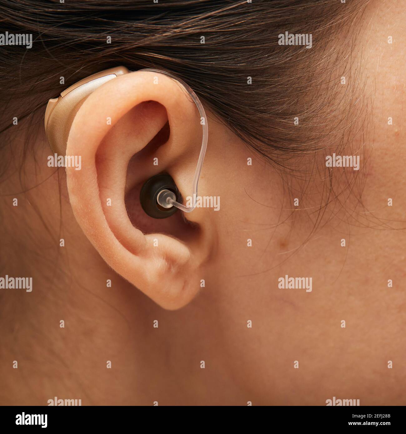 Hearing aid behind the ear woman, close-up, side view. Deafness ...