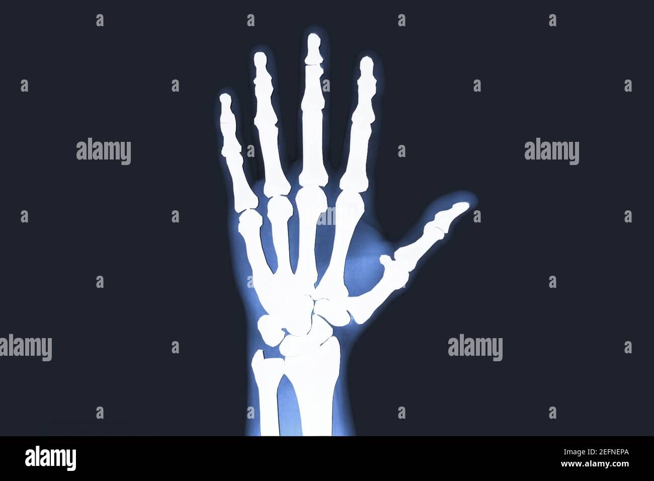 Human hand x ray hi-res stock photography and images - Alamy