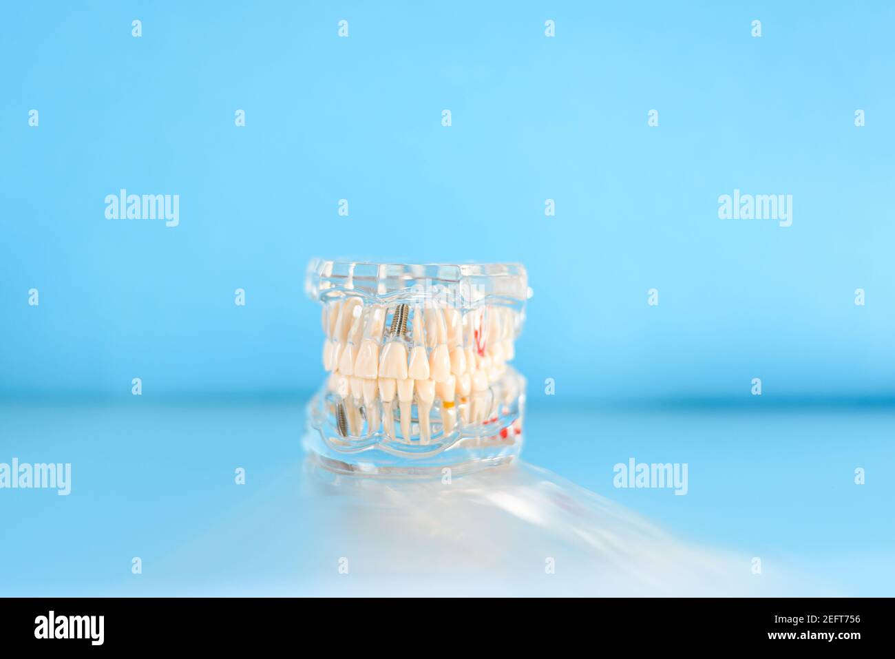Plastic model of a jaw with complete teeth for study, isolated on ...