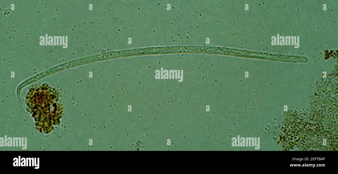 Onchocerca volvulus mf1 DPDx Stock Photo - Alamy