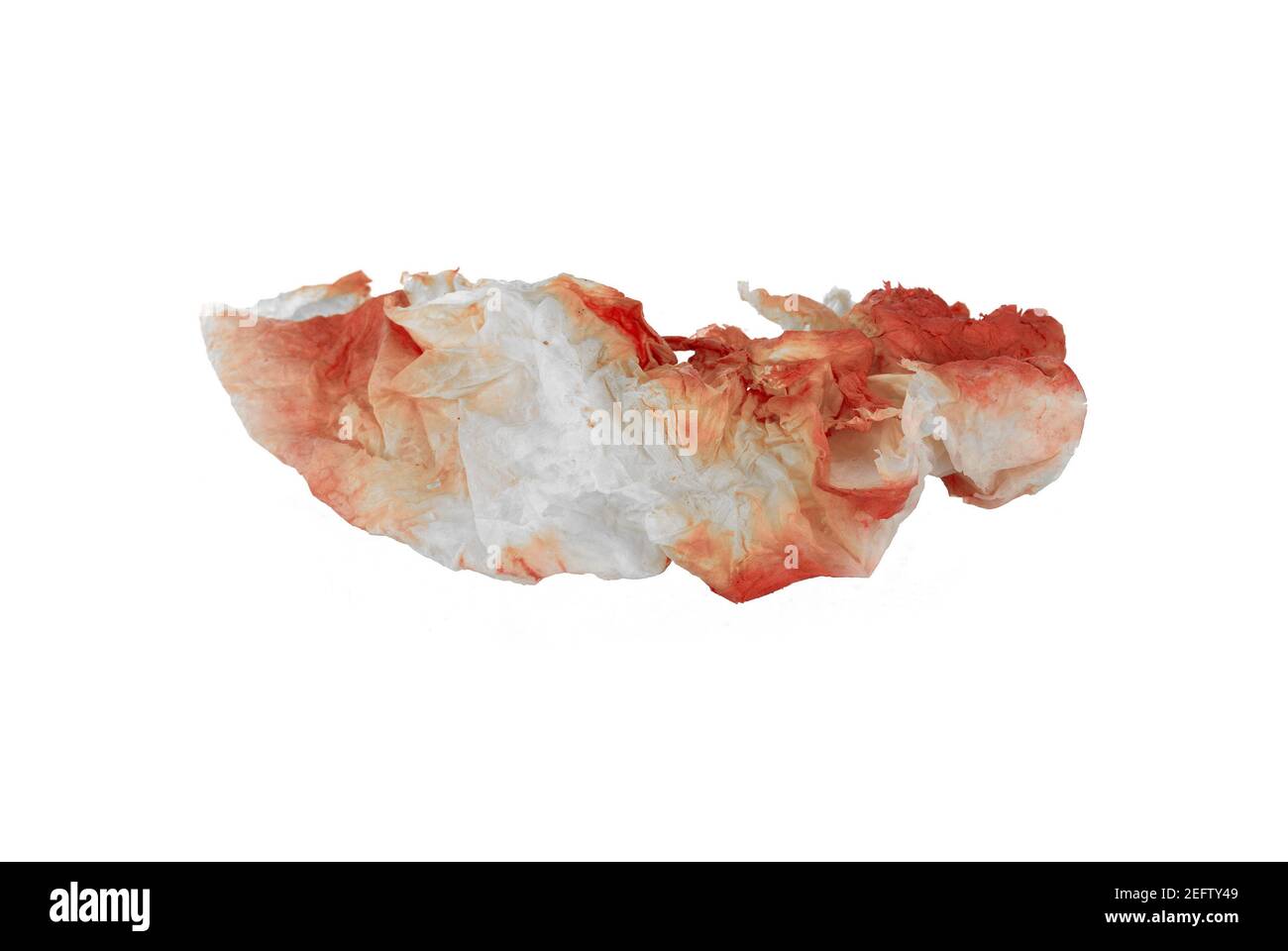 Blood in tissue paper on a white background. Epistaxis (nosebleeds ...