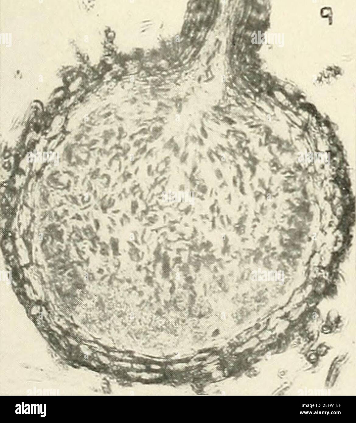 Perithecium hi-res stock photography and images - Alamy