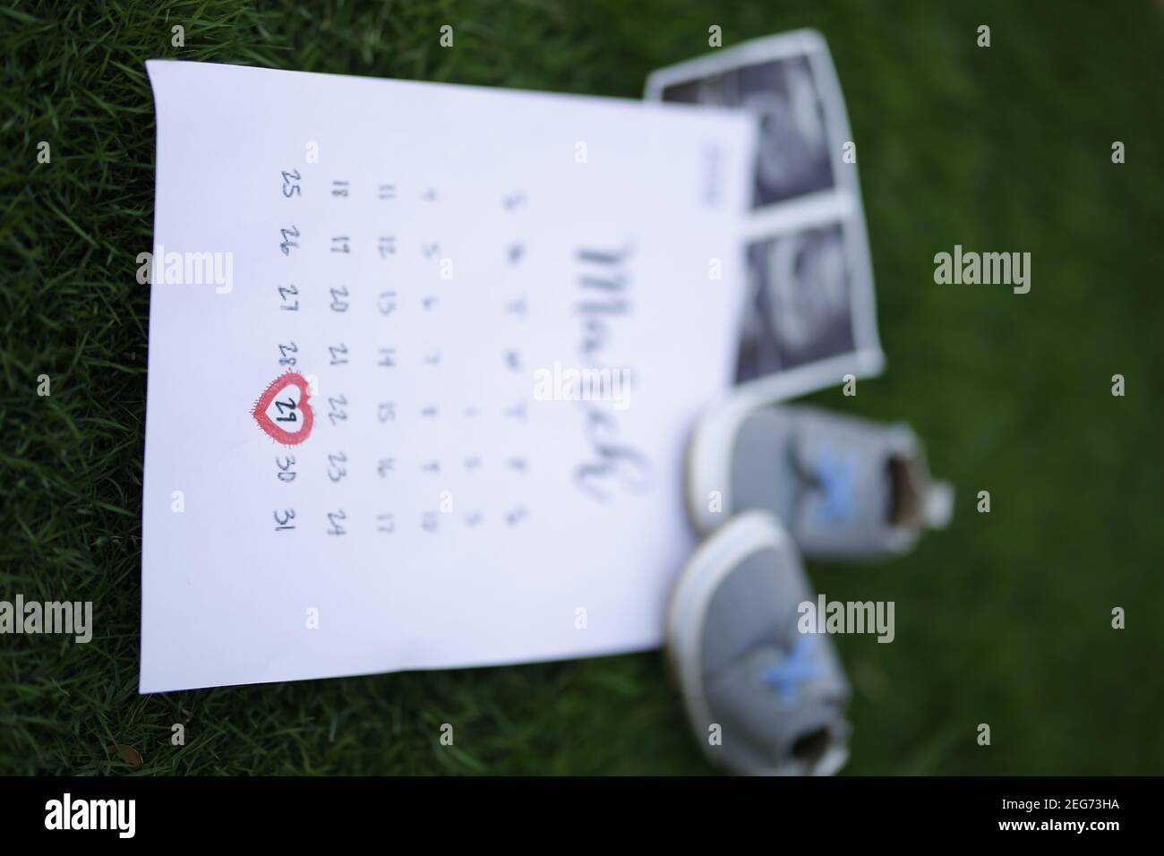 Closeup shot of the ultrasound of the baby, baby shoes and a calendar ...