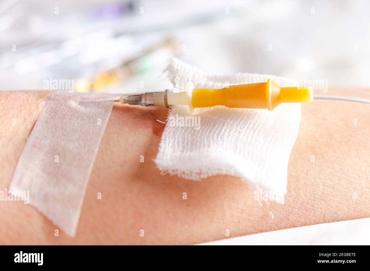 Intravenous injection. The drip is intravenous. First aid. Medicine ...