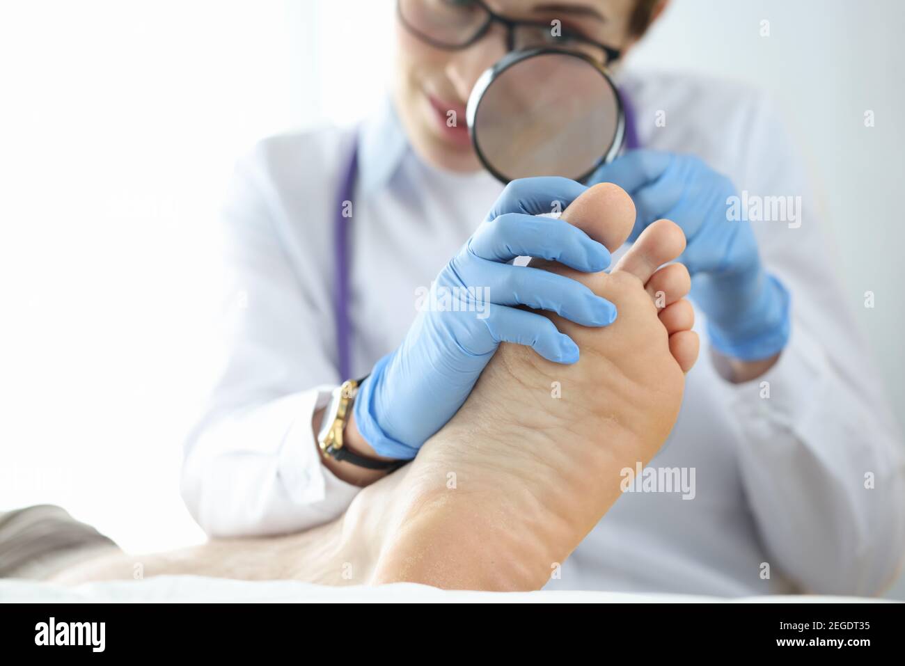 Dermatologist examining toenail with magnifying glass closeup Stock ...