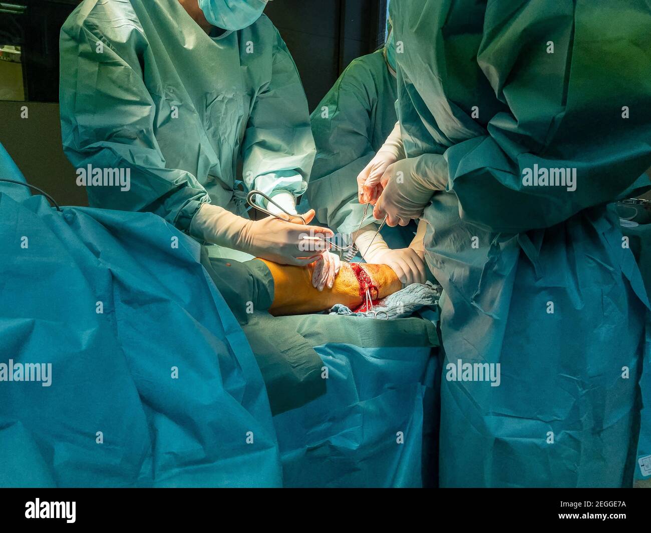 Amputation Amputated High Resolution Stock Photography and Images - Alamy